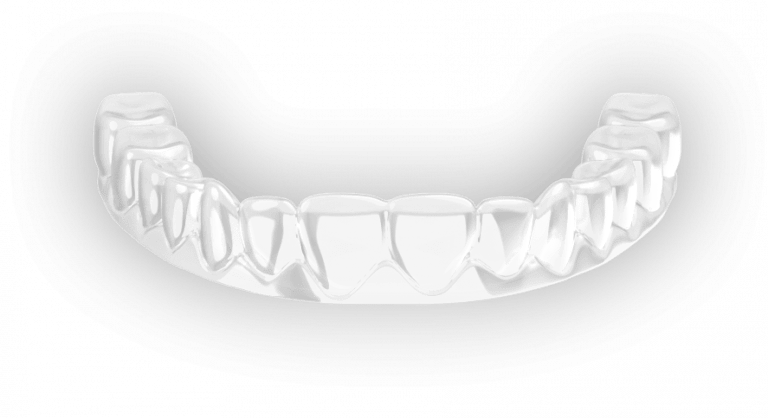 Clear dental aligners - Smilers in Algeria - Khelil's Dental Center